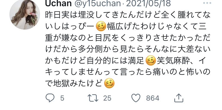 Uchanって？本名や年齢などプロフィール！整形はしてる？プロデュースの帽子が気になる♡ | havicoco